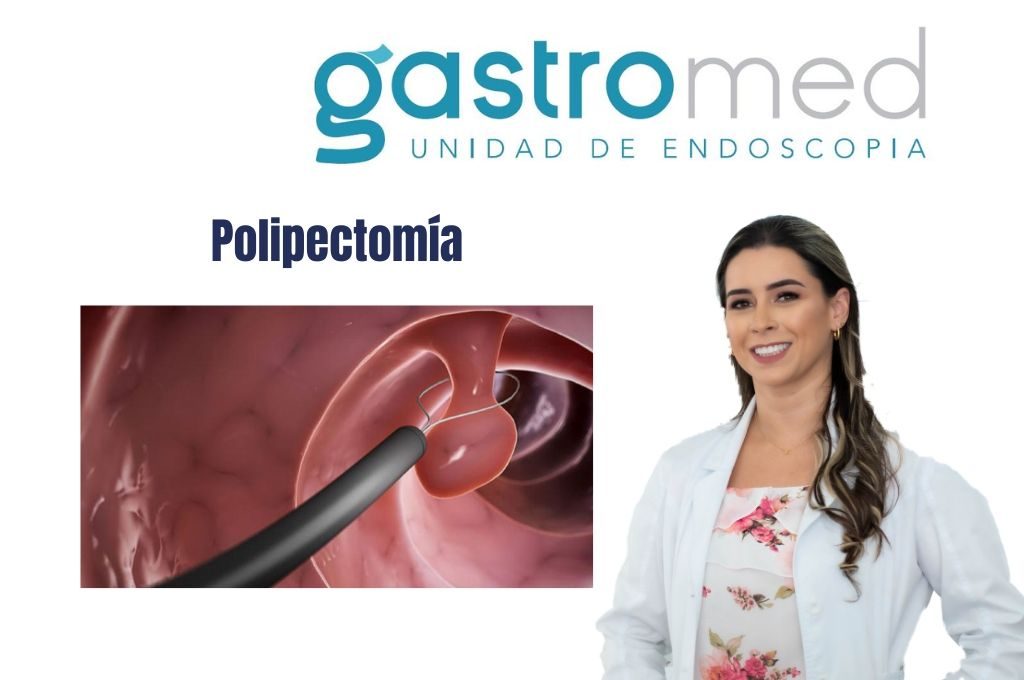 Polipectomía - GASTROMED Unidad de Endoscopia - Cúcuta